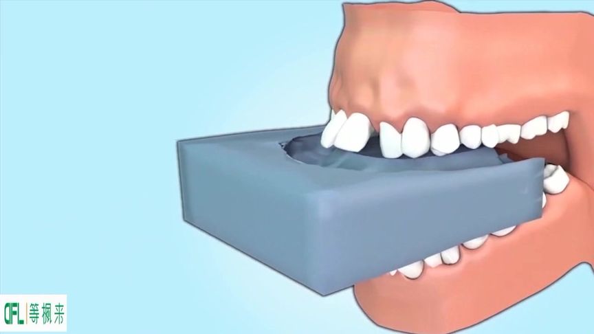 堪比整容!3D演示牙齿正畸过程,想戴牙套瘦脸的同学看看