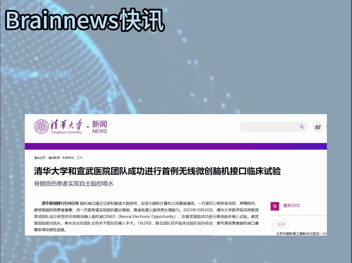 清华大学和宣武医院团队成功进行首例无线微创脑机接口临床试验