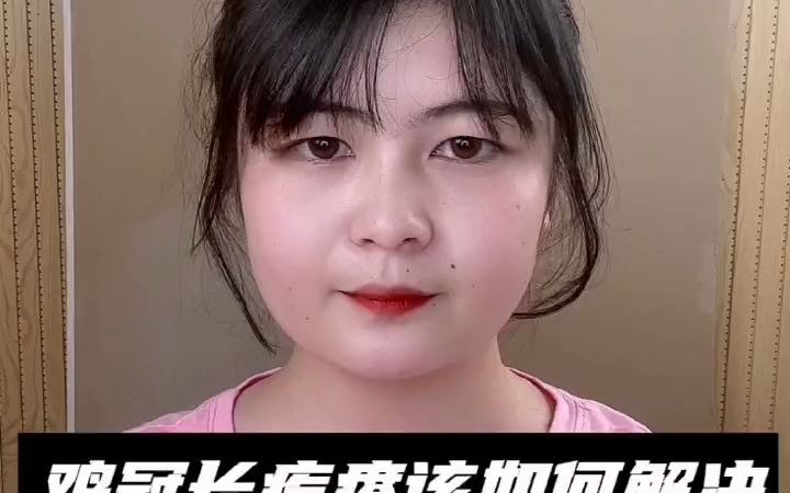 小鸡头上长疙瘩是怎么回事 小鸡长鸡痘怎么办鸡长痘痘是什么原因鸡...