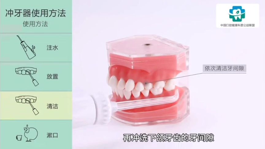 冲牙器的正确使用方法#口腔健康
