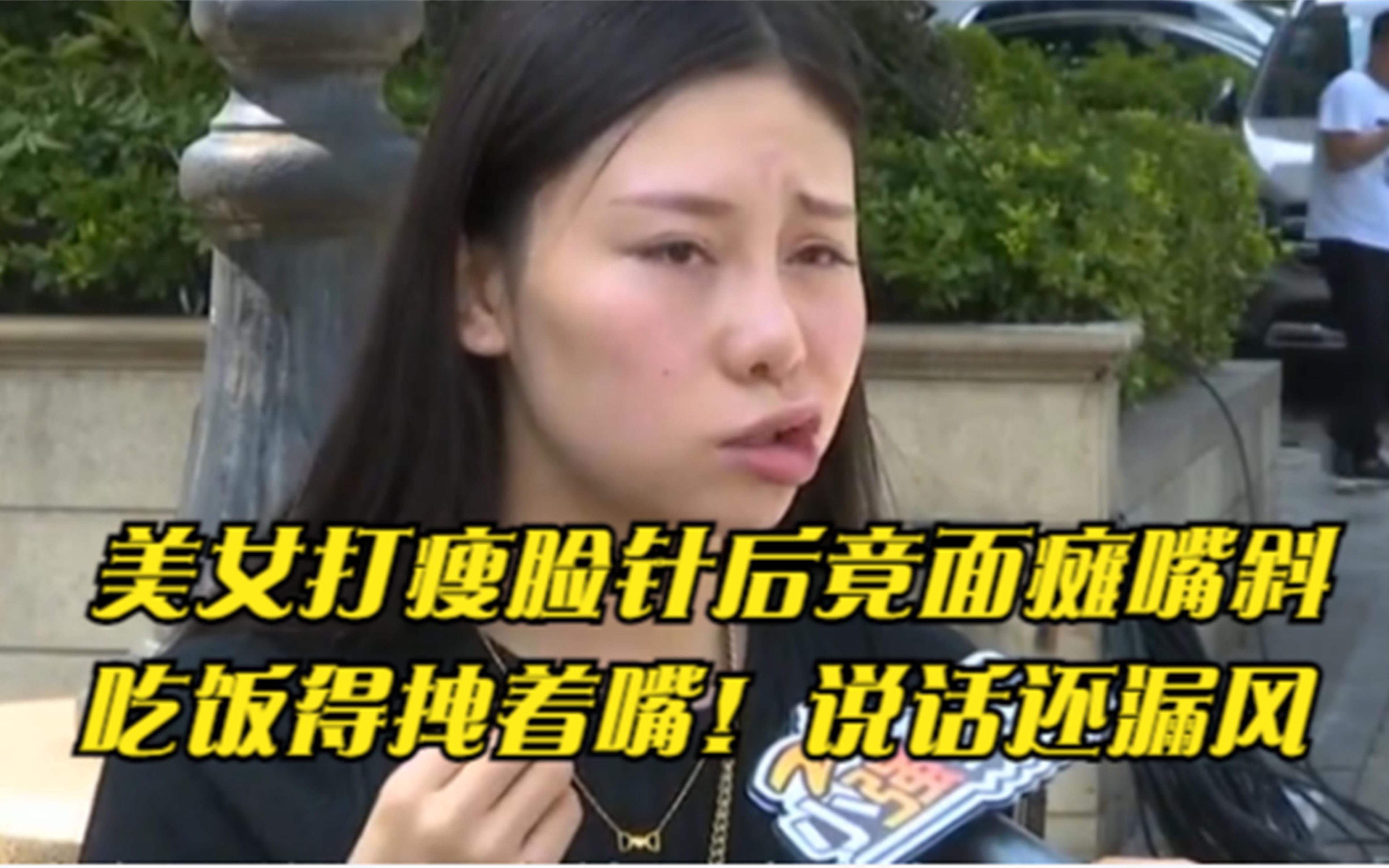 美女打瘦脸针后竟面瘫嘴斜!吃饭还得拽着嘴!说话漏风又漏口水!