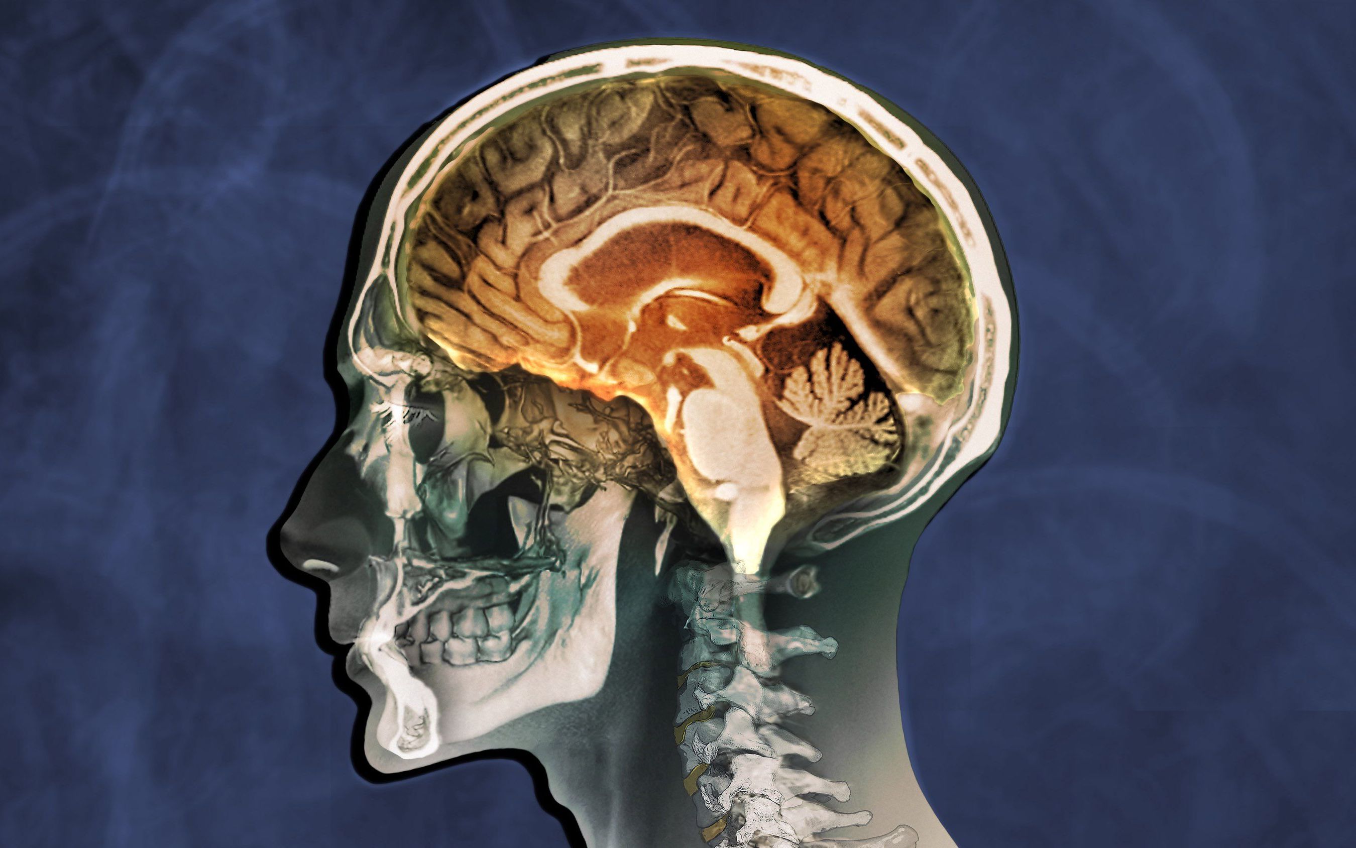 一位女性在午餐时喝下了35%浓度的过氧化氢溶液,这是她的大脑发生...