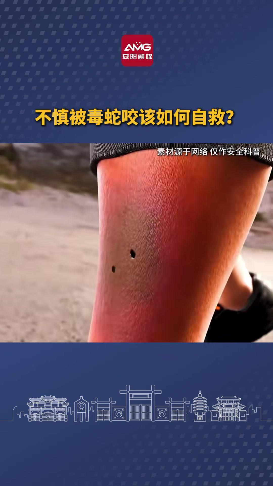 不慎被毒蛇咬该如何自救?#安全生产(来源:应急管理部发布:臻臻)