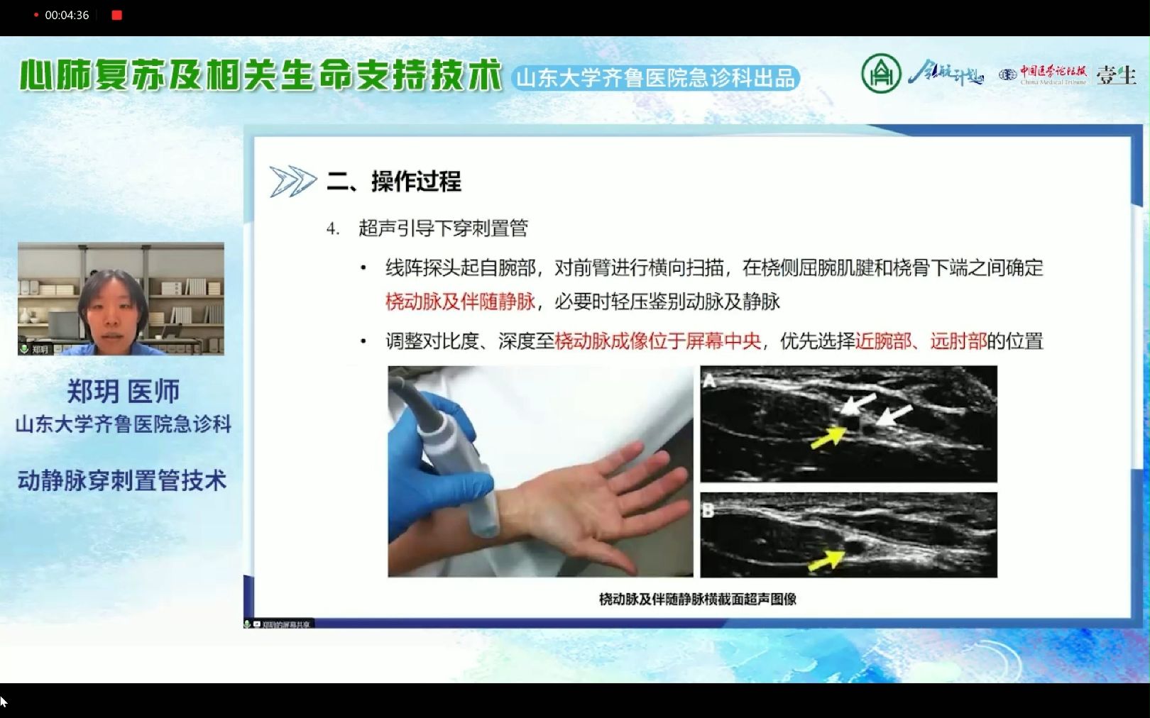 医生小白初学指南 动静脉穿刺置管技术