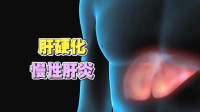 检查肝功能,这几个指标要重视,肝癌隐患一目了然