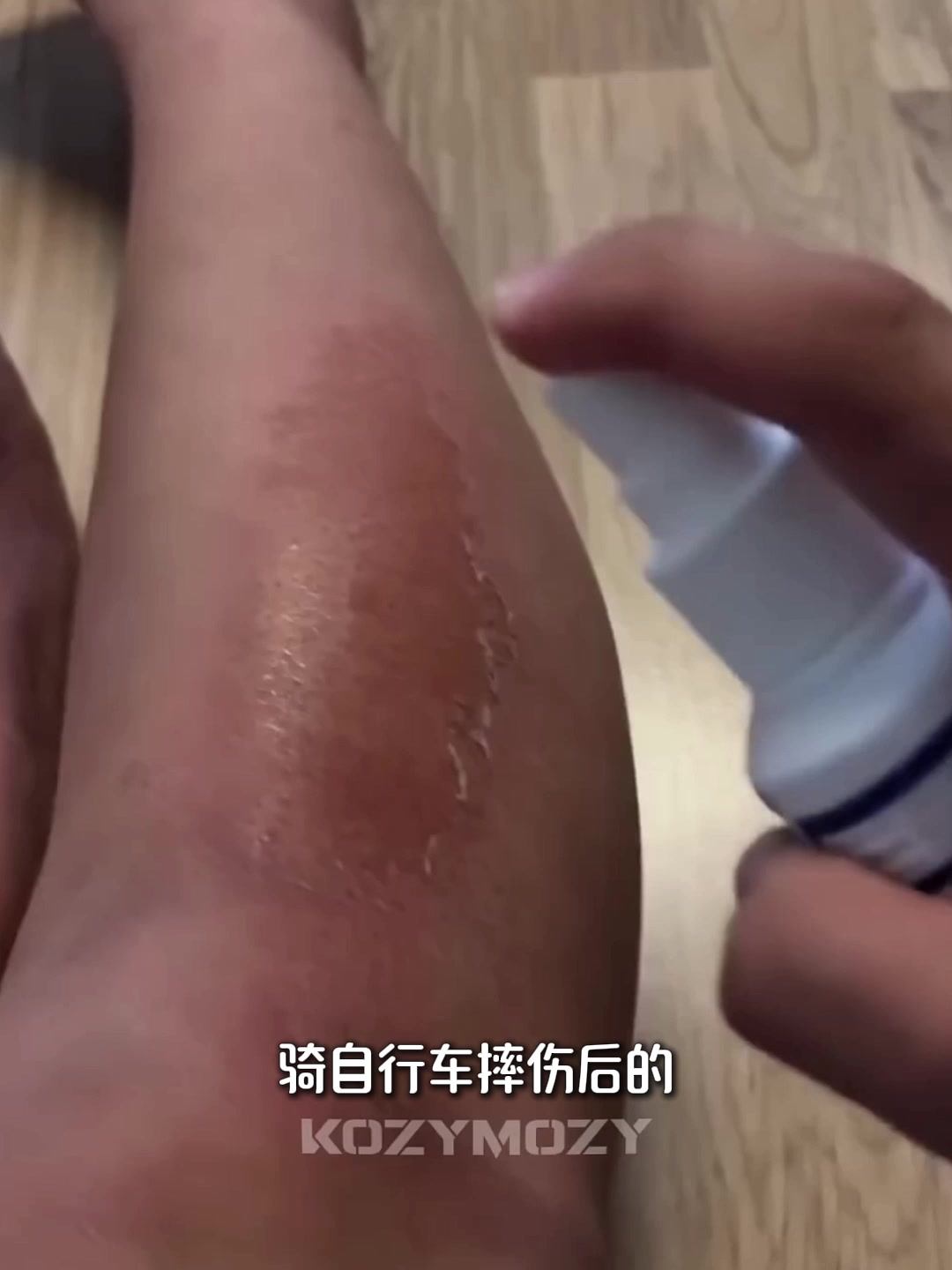 为什么伤口不宜反复用双氧水?