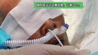 超声引导下脉冲式注水法鼻肠管置入