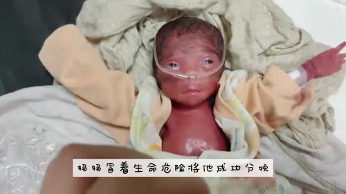 孕妇零产检,宝宝出生后医生震惊发现惊人真相!