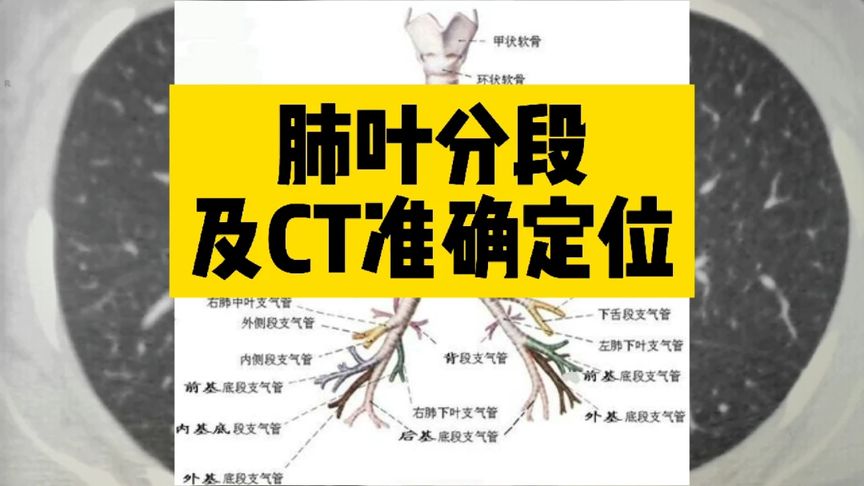 最详细胸部CT支气管精准分段,放射及临床医生入门基础,必掌握!