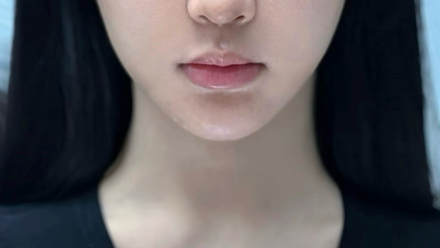 「自叠」只有一个功效 下半张脸又窄又尖 含身体结果推注器 包括脂肪...