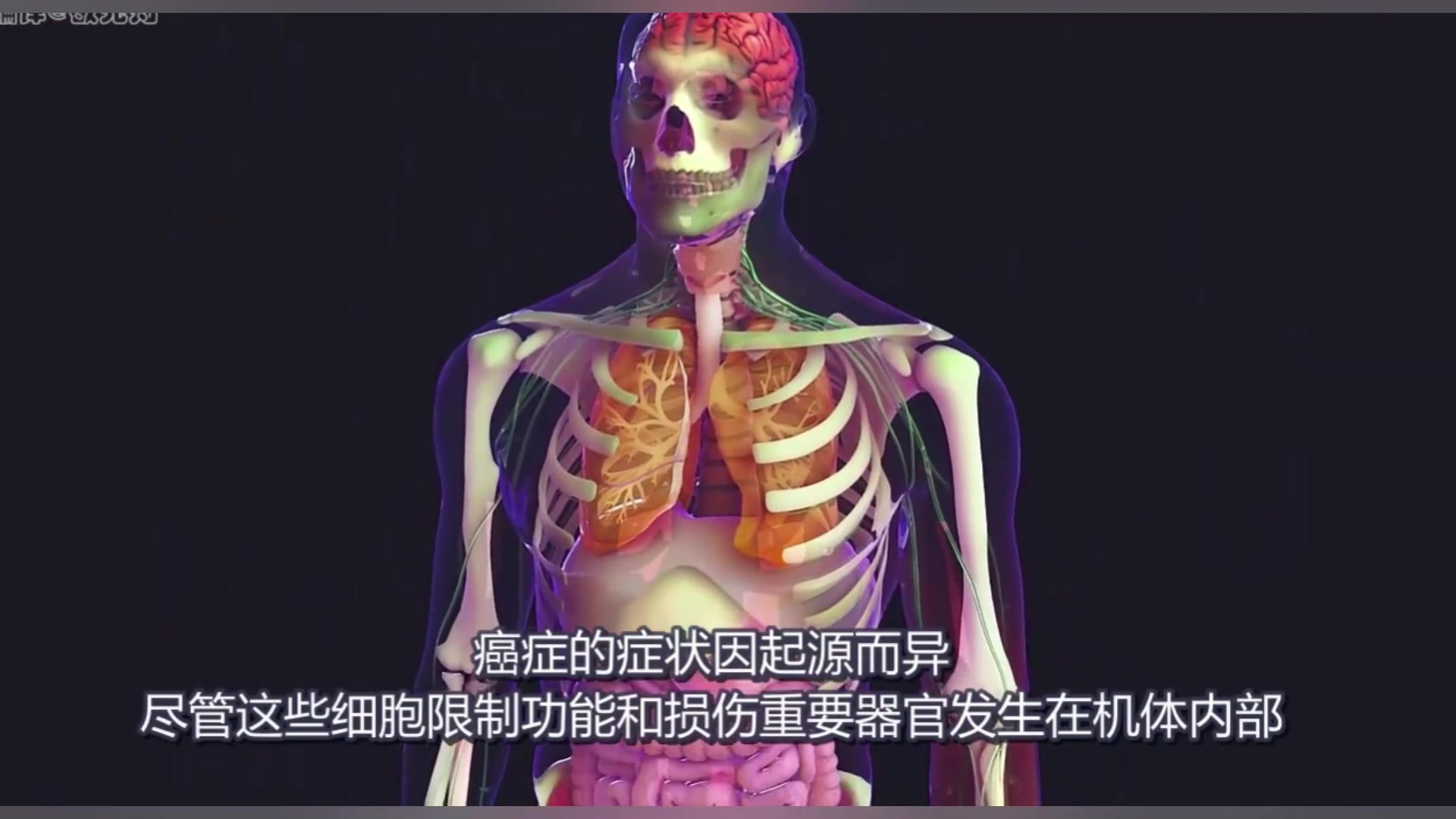 在医学上,癌是指起源于上皮组织的恶性肿瘤,是恶性肿瘤中最常见的...