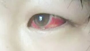 甲醛中毒的常见症状 出现这几种情况要及时去医院