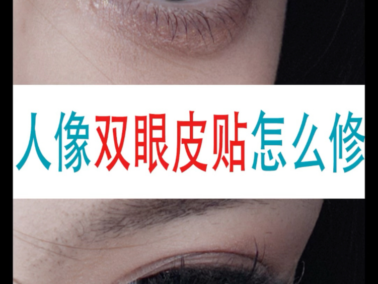 PS人像修图教程:双眼皮贴怎么修?