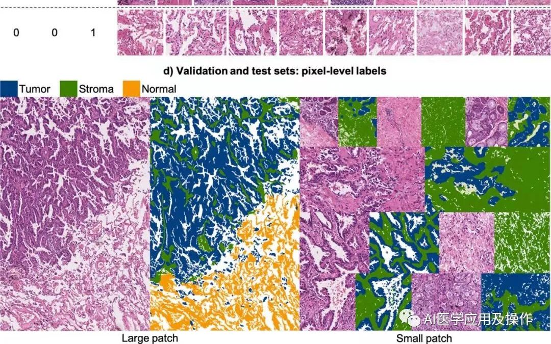 医学影像组学之病理切片分割