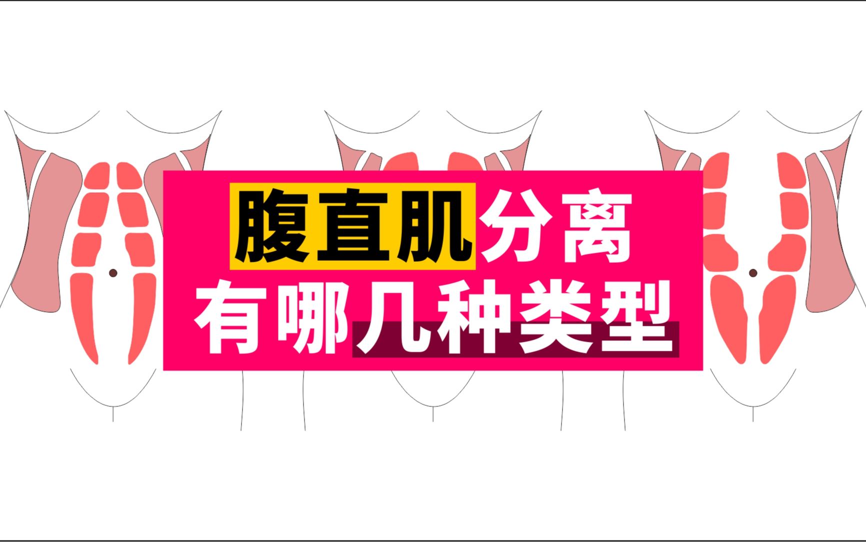 3种分离类型,都有那些特征,看看你中招了没?