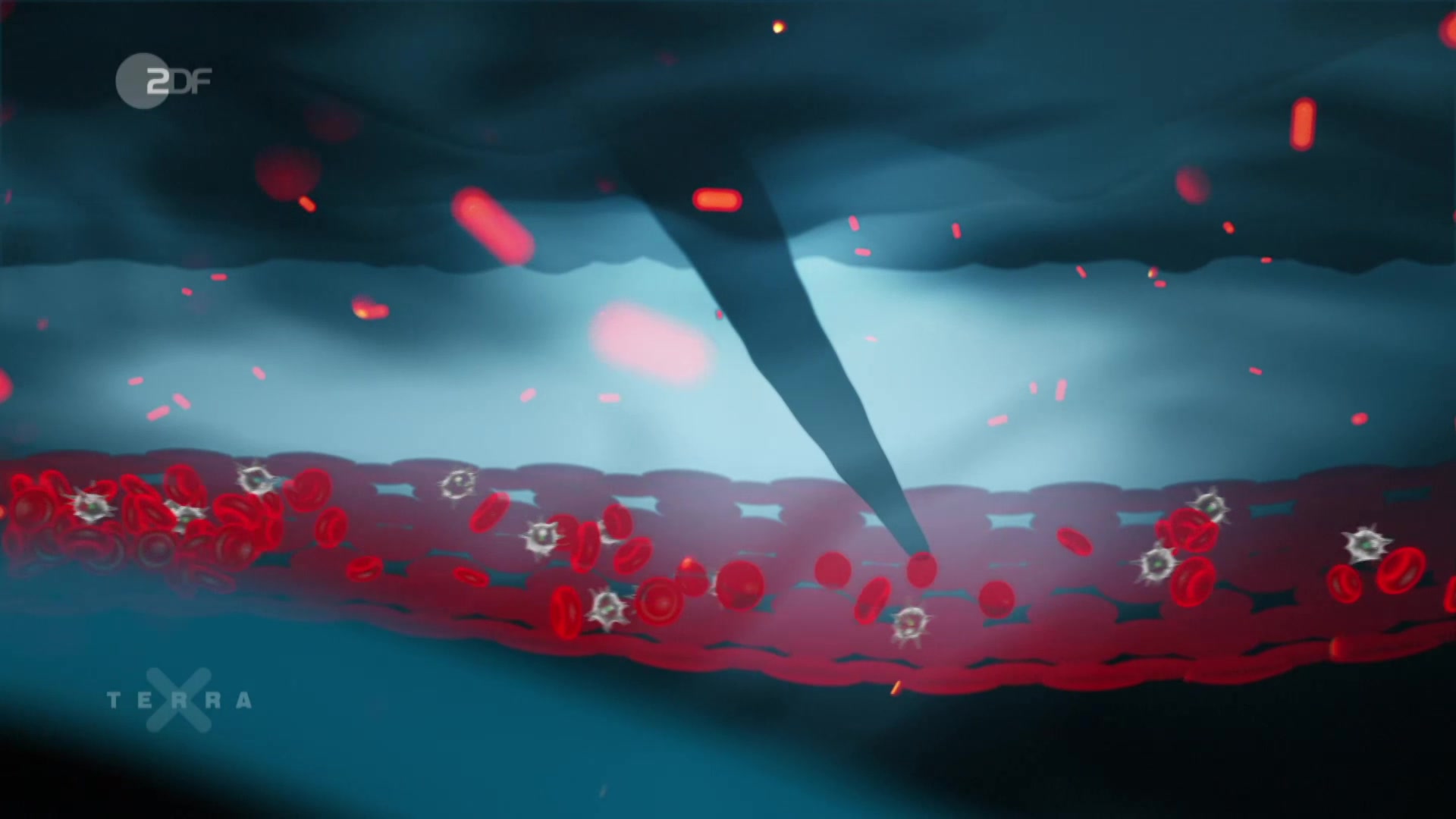 ...受损组织中的吞噬细胞最先做出反应。所谓的 M1 型巨噬细胞会释放...