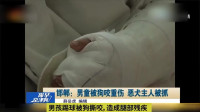 社会纪实:近年来,严重的恶狗伤人事件!爱狗人士怎么看?