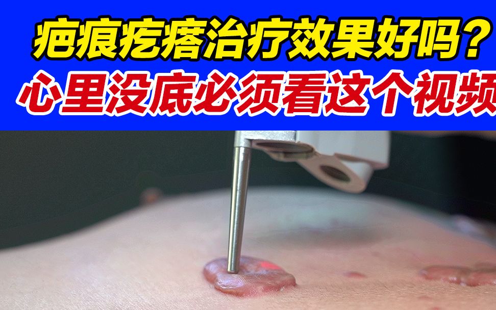 疤痕疙瘩治疗效果好吗?保定华仁疤痕修复-河北保定祛疤痕医院-河北省...