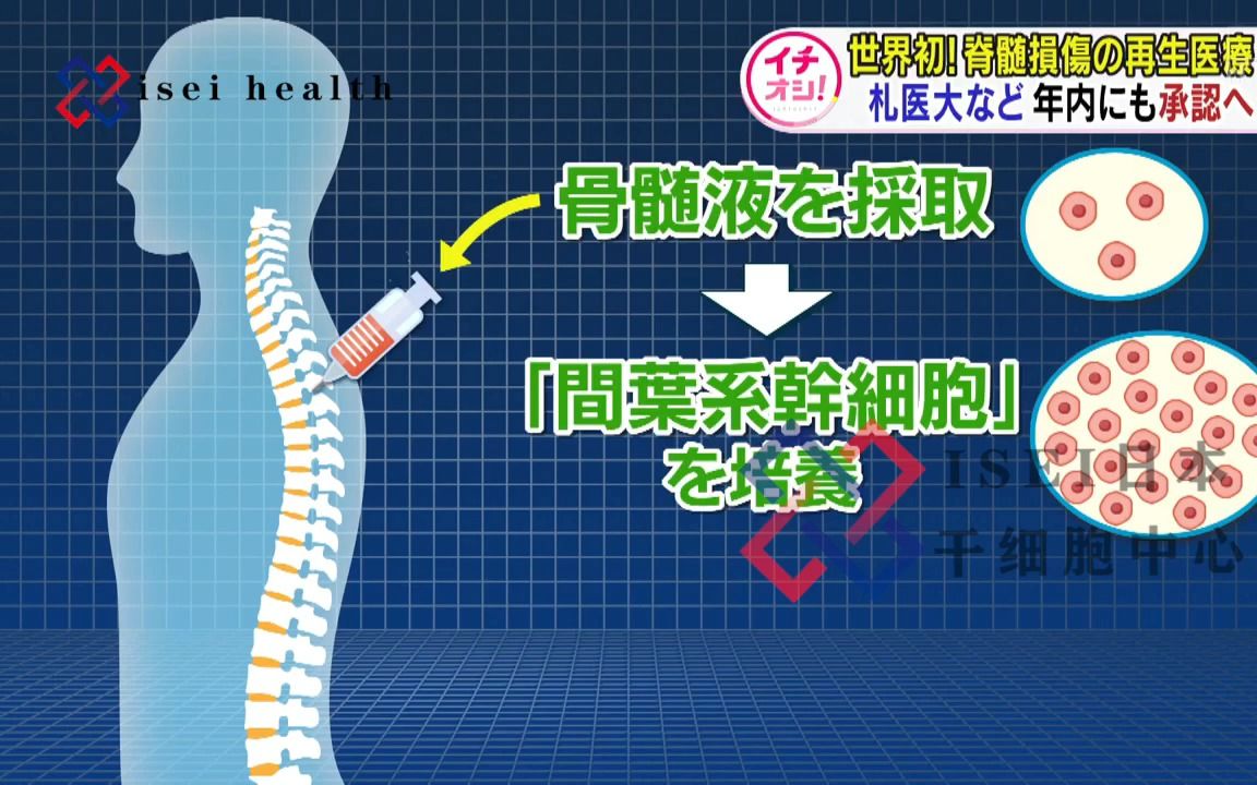 ISEI日本干细胞—全球首个脊髓损伤干细胞的临床试验!