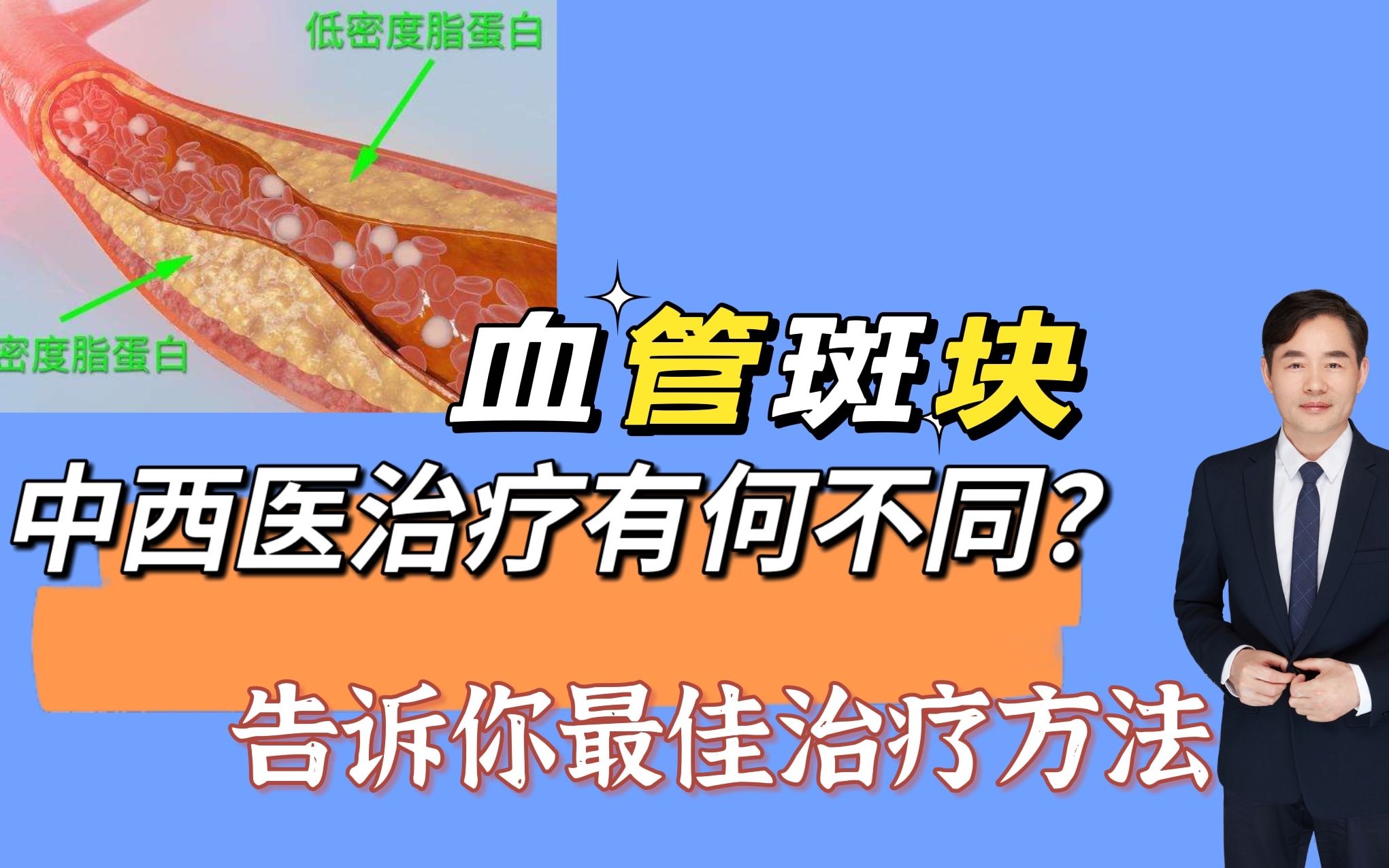 血管斑块,中西医治疗有啥不同?怎样治疗效果好?告诉你方法
