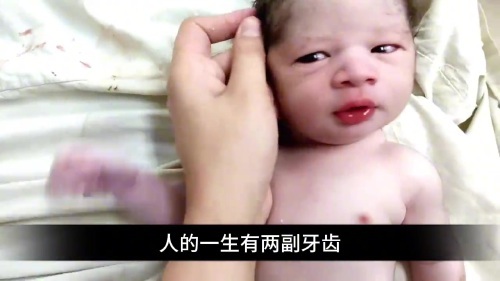 刚出生的宝宝,令妈妈惊吓落泪,医生检查后却露出了笑容