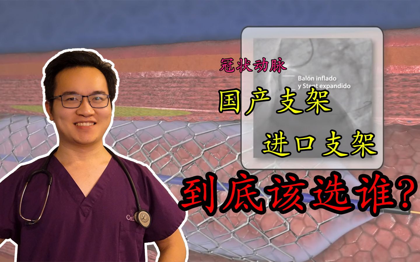 心脏支架,国产好还是进口好?有什么区别?如何选择?
