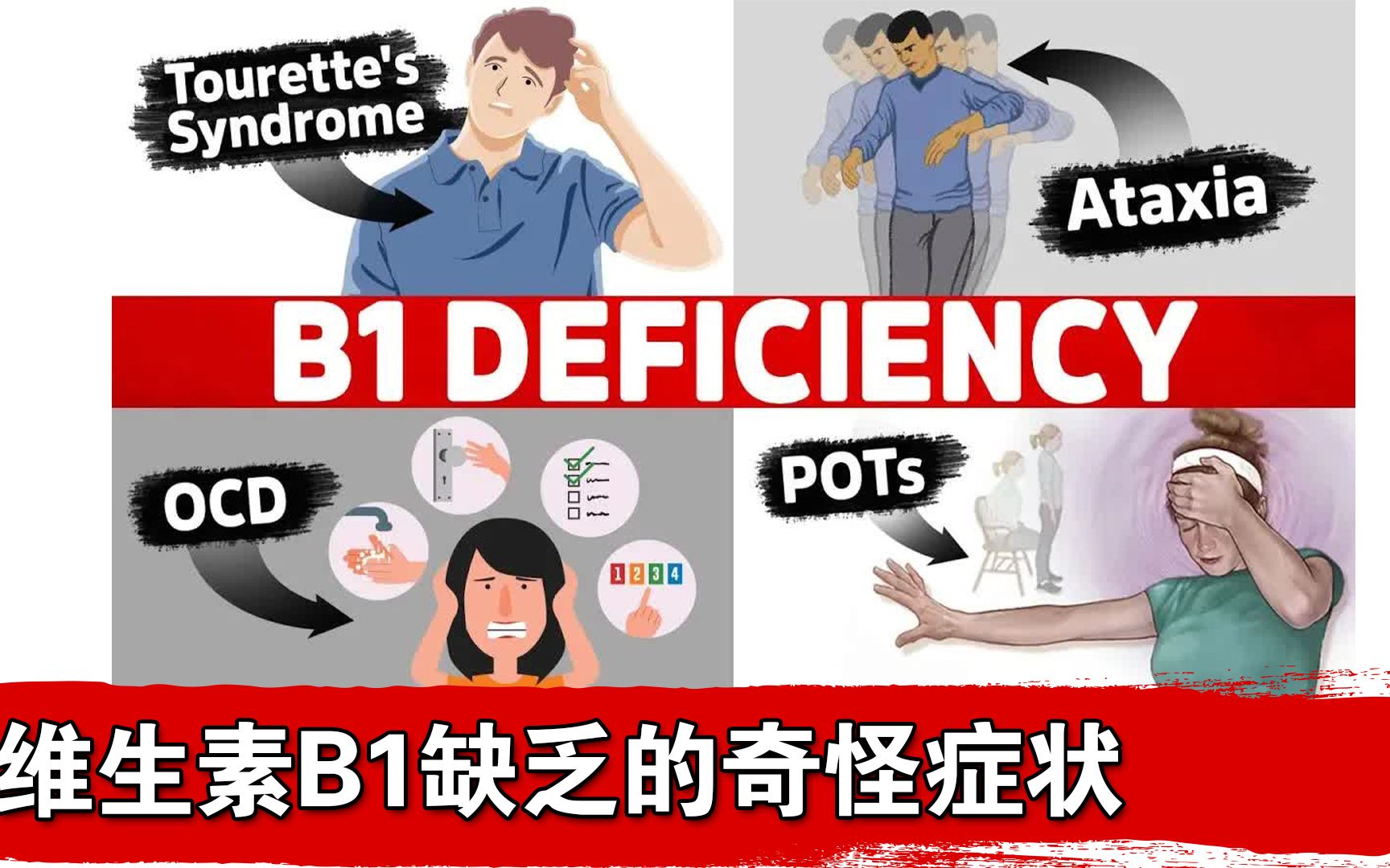 维生素B1缺乏有一些你可能未听说过的症状!