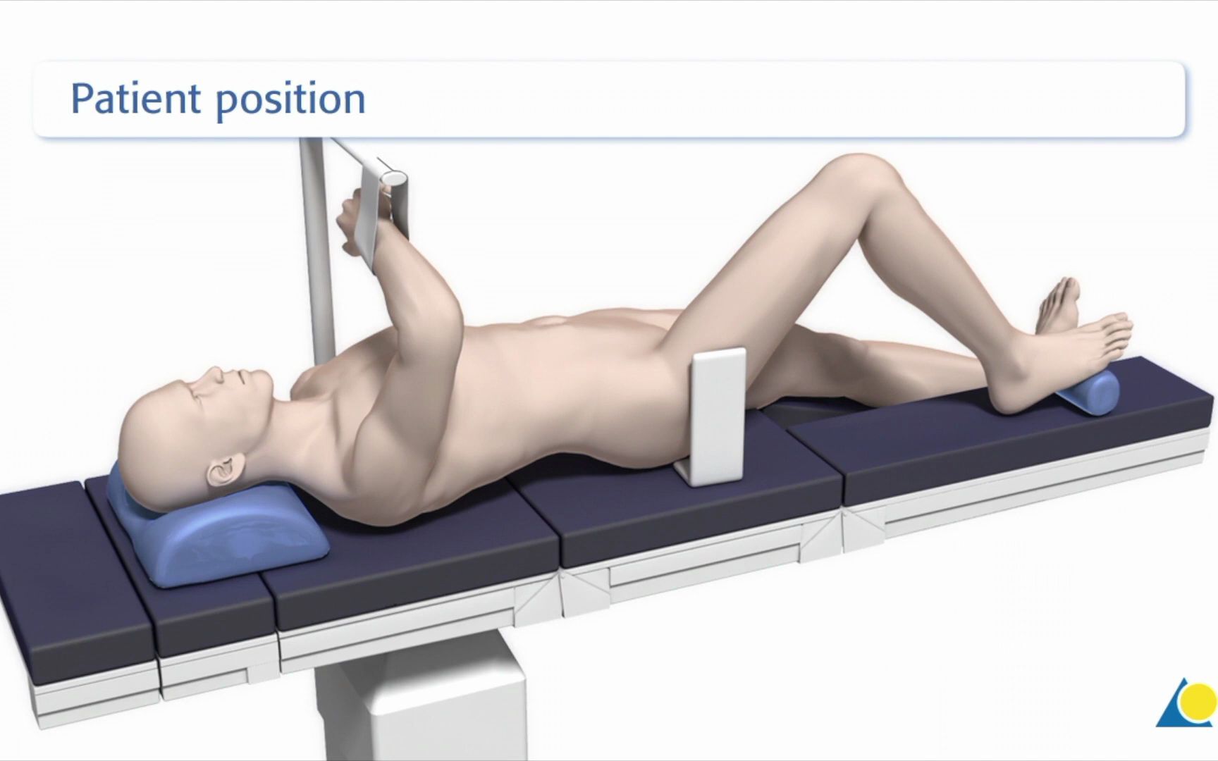 双平面开放楔形胫骨截骨术