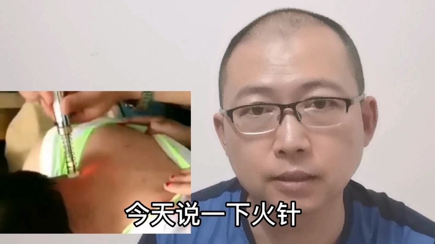 中医火针疗法科普