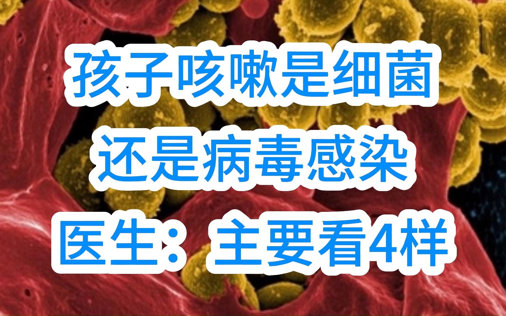 孩子咳嗽是细菌,还是病毒感染,医生:主要看4样