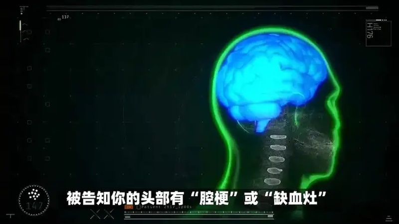 检查发现"腔梗""缺血灶",这是脑梗吗究竟用不用治