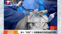 深入“红区”!记者直击ECMO上机过程