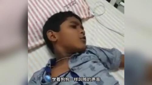 小男孩被狗咬了没有及时处理 不久后就爆发了