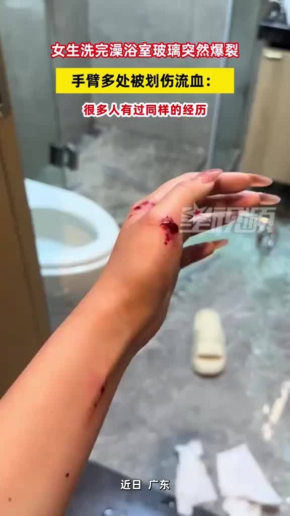 女生洗完澡浴室玻璃突然爆裂,手臂多处被划伤流血:万幸是小擦伤