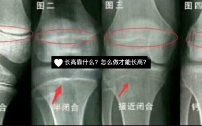 长高靠什么?怎么做才能长高?