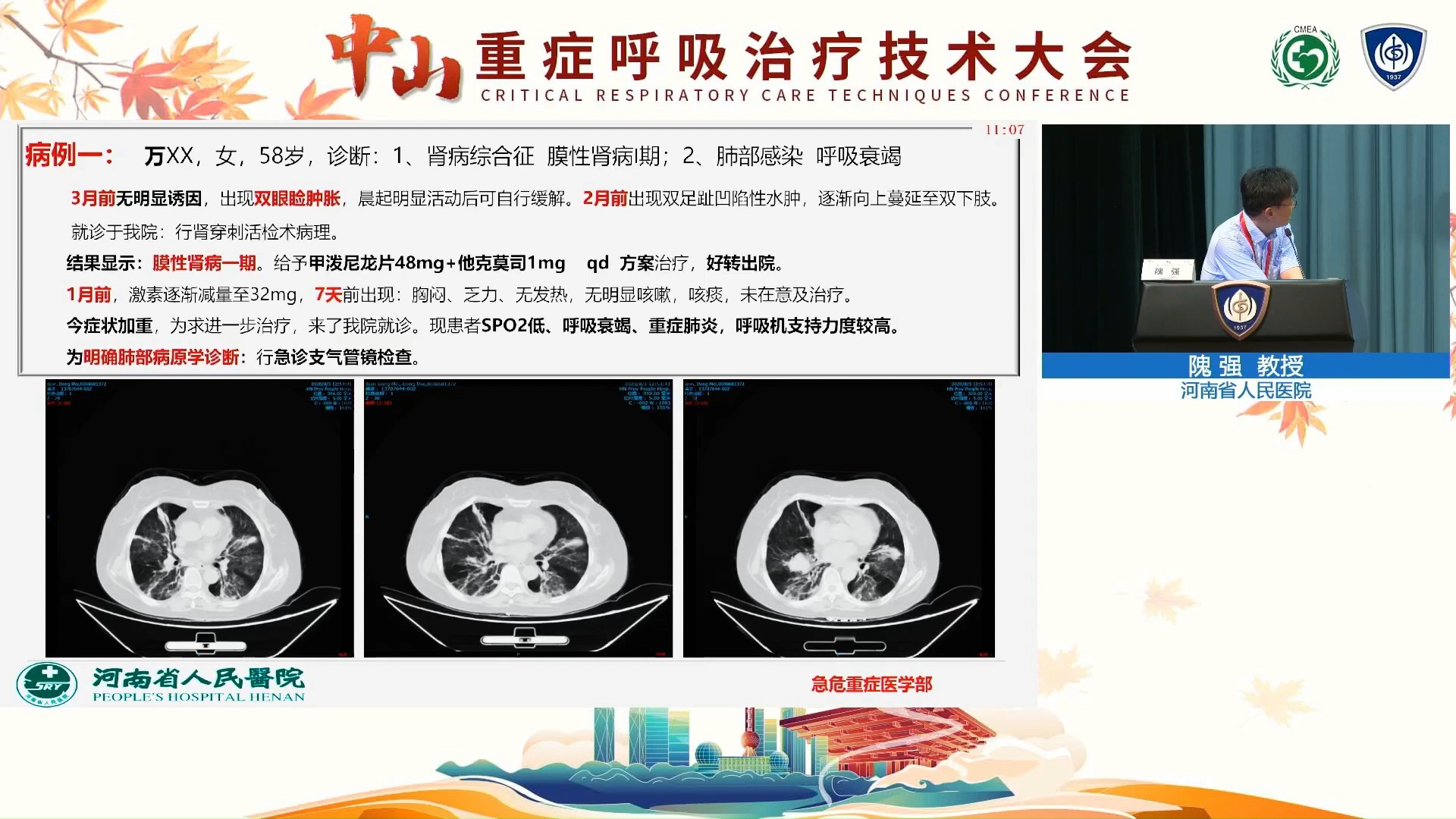 ICU内气管镜:标准和质控 隗强