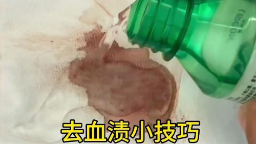 去除血渍实用小技巧!