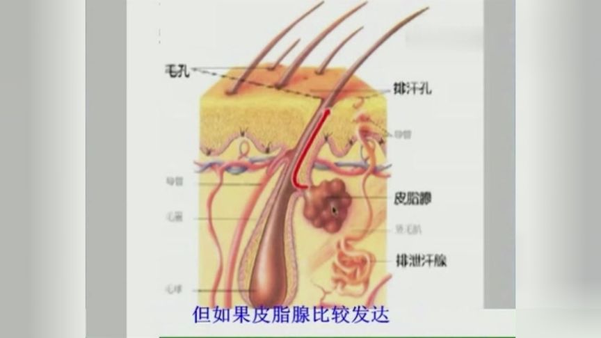 痘痘形成原理动画