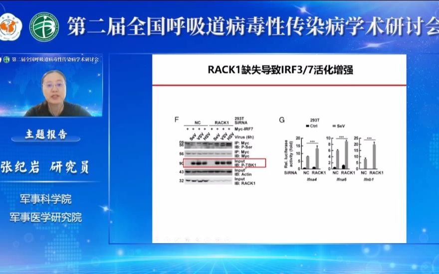 H1N1感染诱导I型干扰素表达的信号转导机制--张纪岩