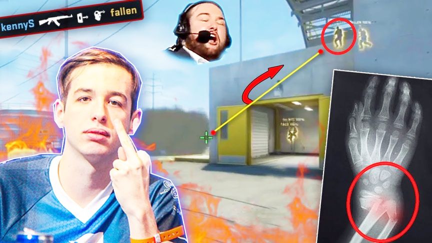 CSGO职业选手手腕值多少钱 KennyS的够购买一车龙狙吧