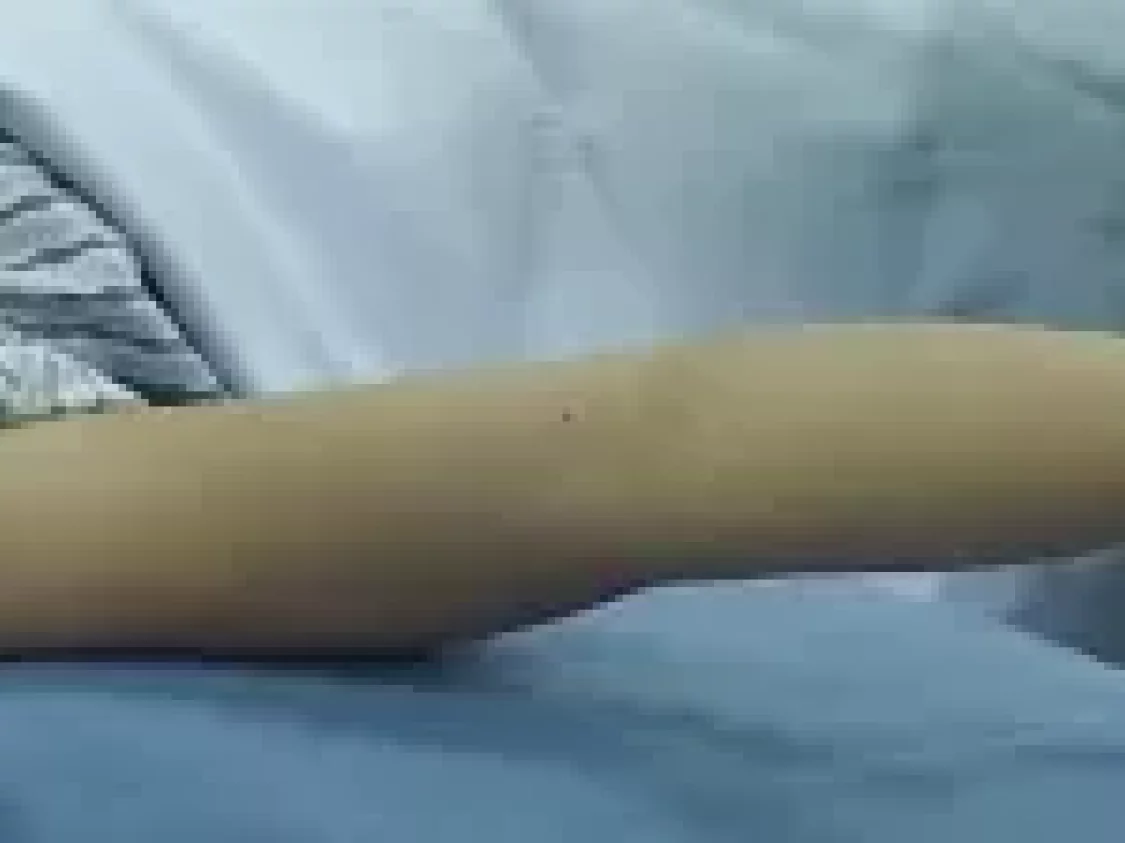 PICC置管操作