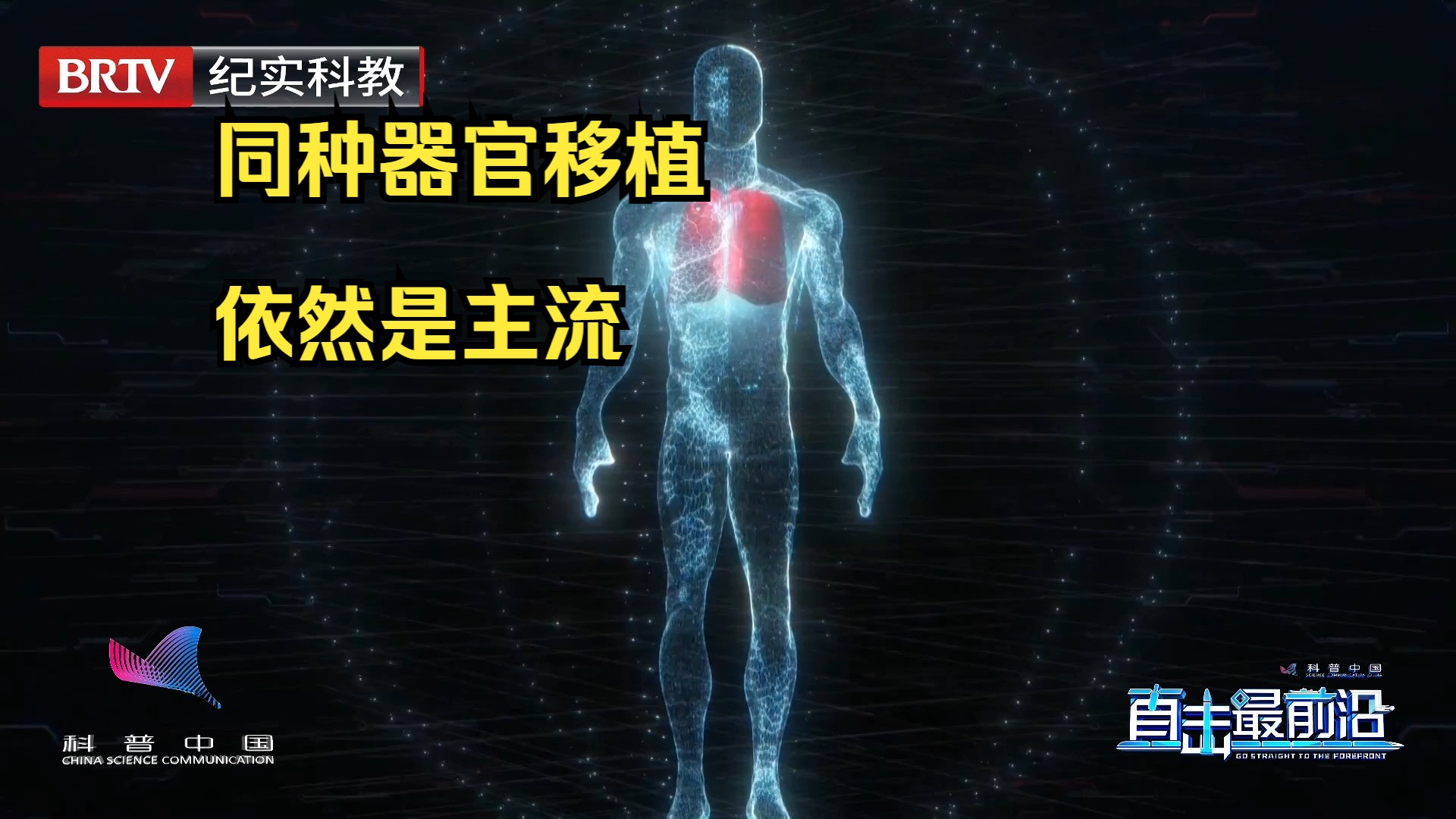 1同种器官移植依然是主流