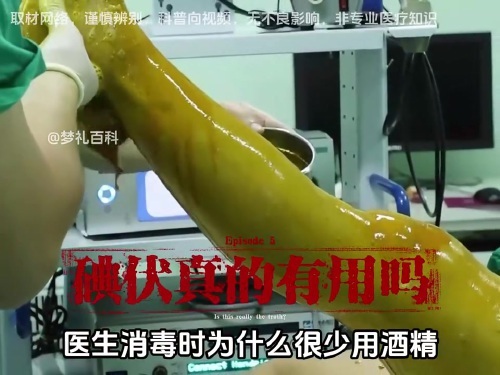 医生消毒时为什么基本都用碘伏