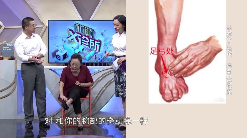 X诊所:如何判断下肢动脉血管是否畅通,专家教你一个小窍门