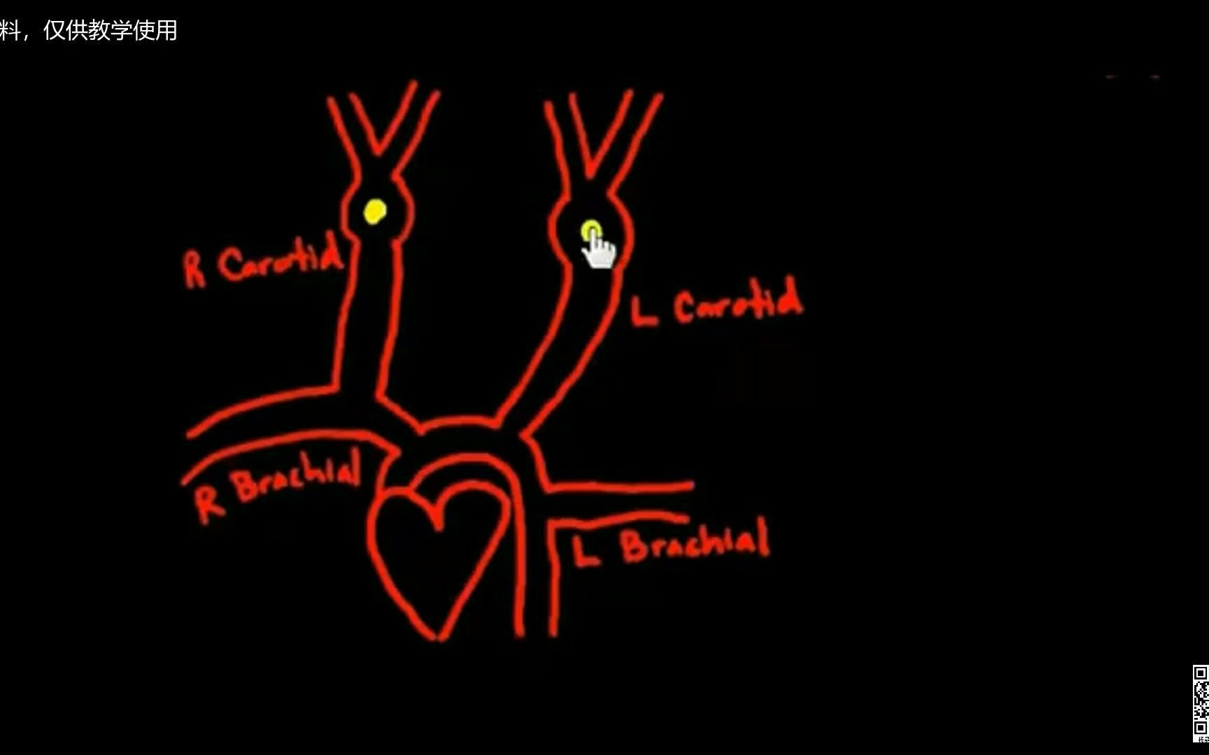 动脉血压的调节