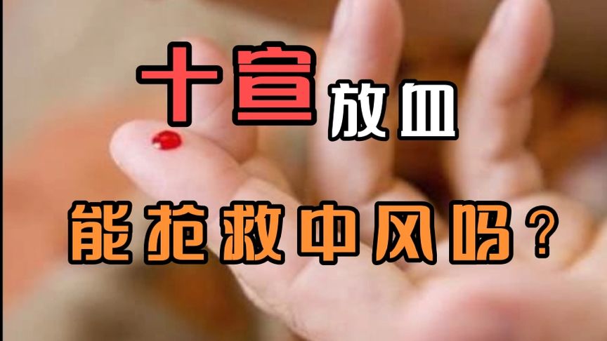 扎手指放血真能抢救脑中风吗?专科医生建议最好按照3个步骤去做
