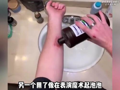 没想到碘伏的杀伤力如此之大