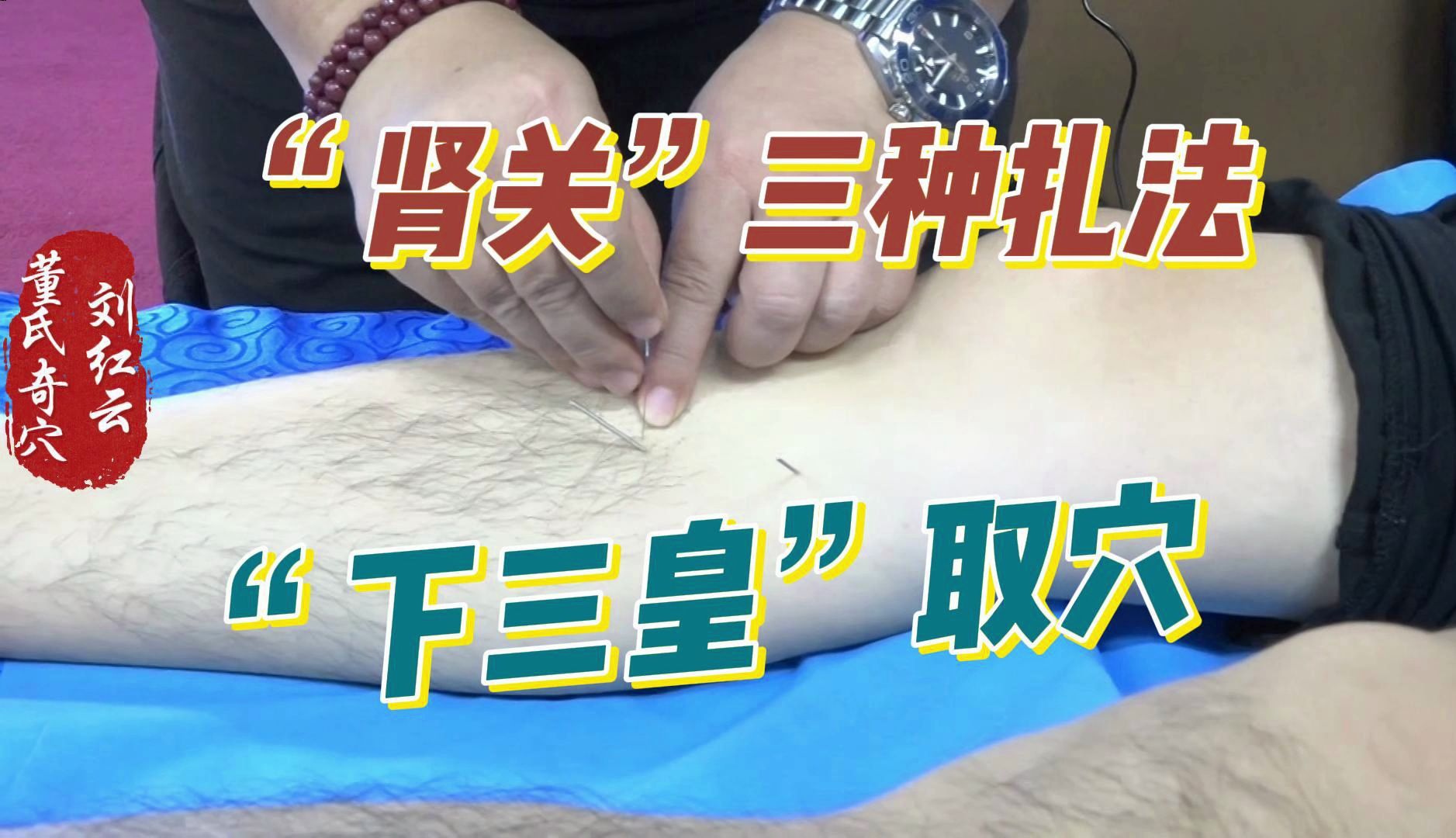 董氏奇穴“下三皇”怎么扎?“肾关”三种不同的扎法!