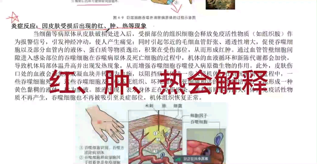 免疫过程中的红肿,发烧现象如何解释?看看炎症反应就明白了