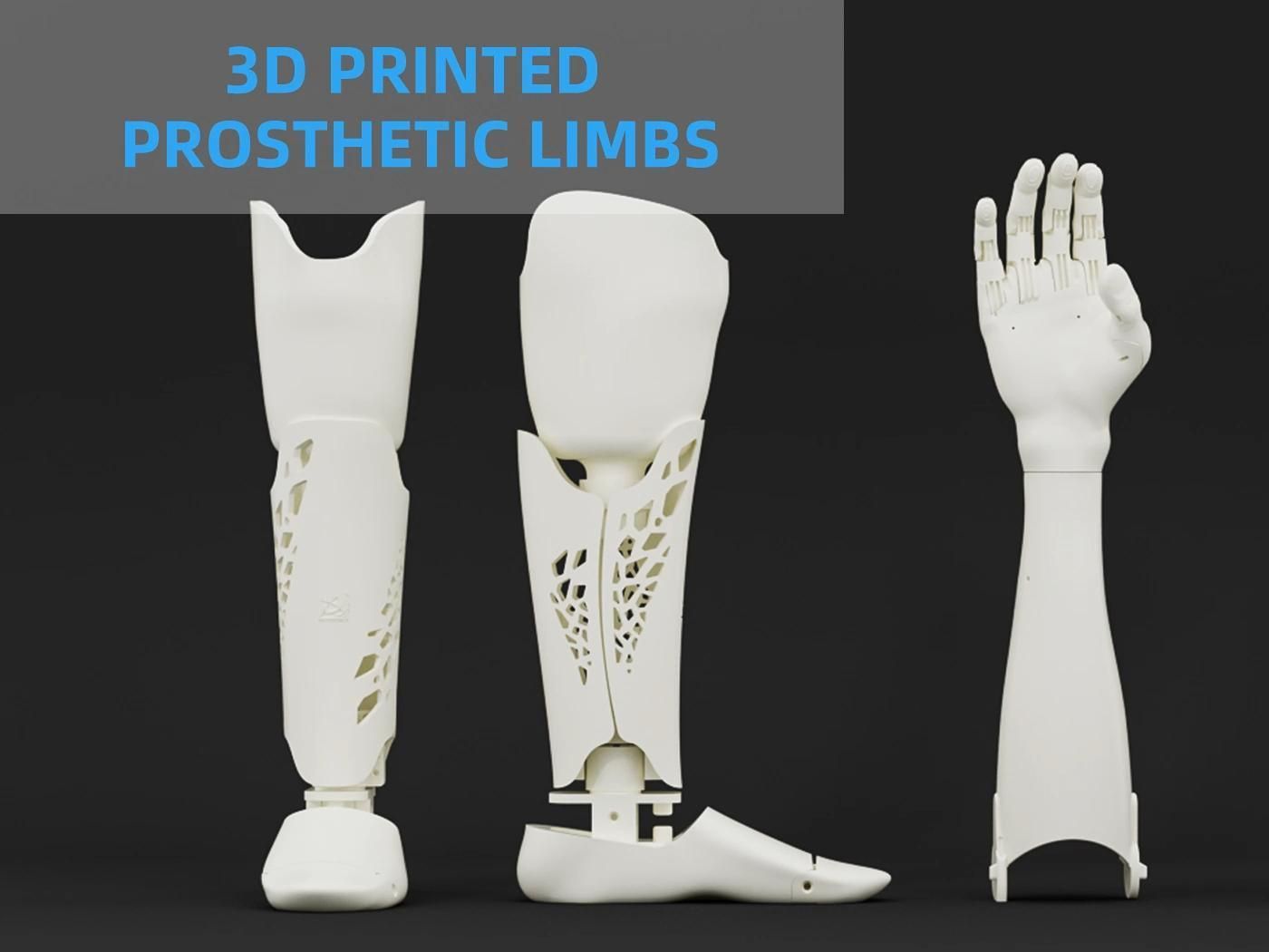 光固化3D打印,在医疗假肢领域应用,科技改变生活